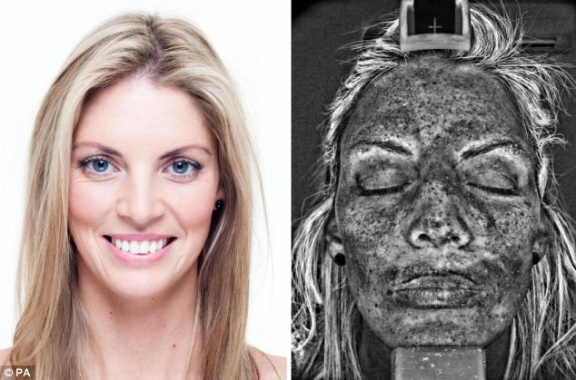 FOTO. Cum arată în realitate pielea după ședințele de bronzat de la solar