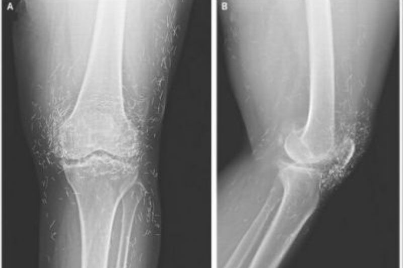 Descoperire facută după o radiografie: "Femeia are o comoară în ...