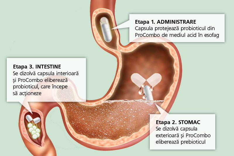 (P) Stomacul îi chinuie pe români