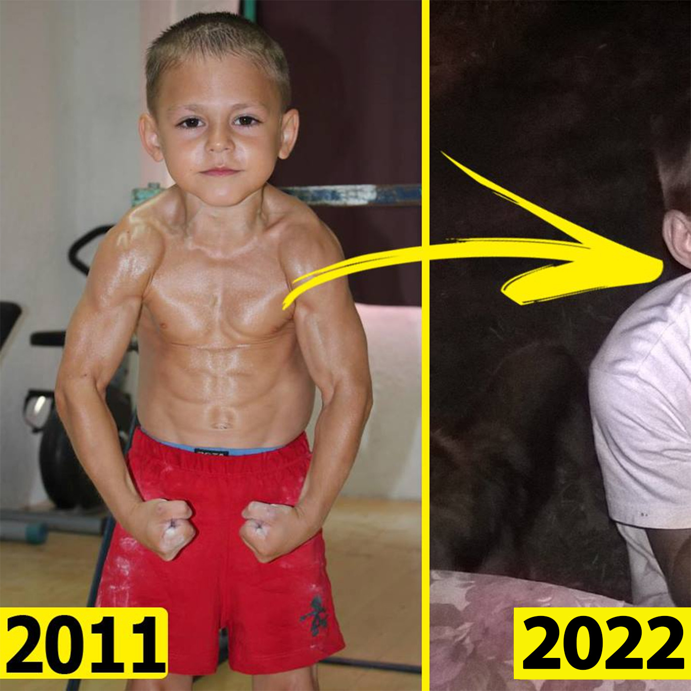 Ireal ce s-a ales de "Micul Hercule". Cum arată la 18 ani