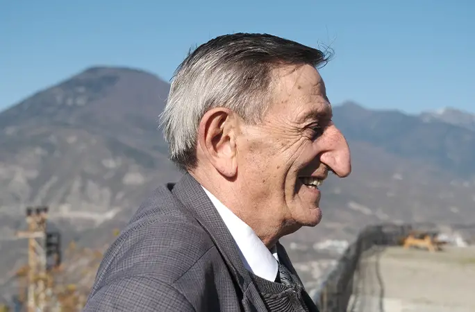 A murit bărbatul cu cel mai mare nas din lume! S-a stins din viață la ...