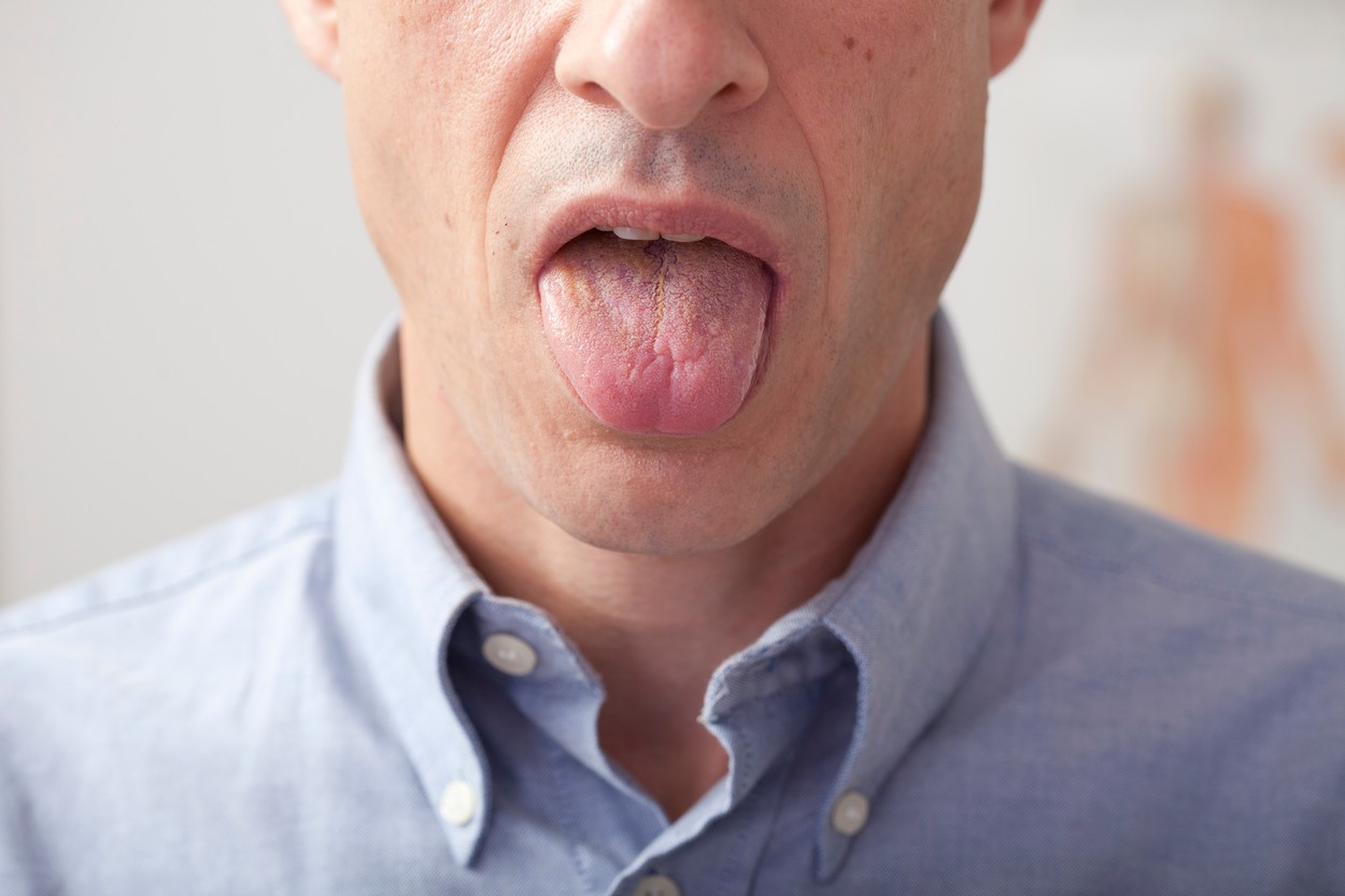 Ce înseamnă dacă LIMBA unui om este prea roșie