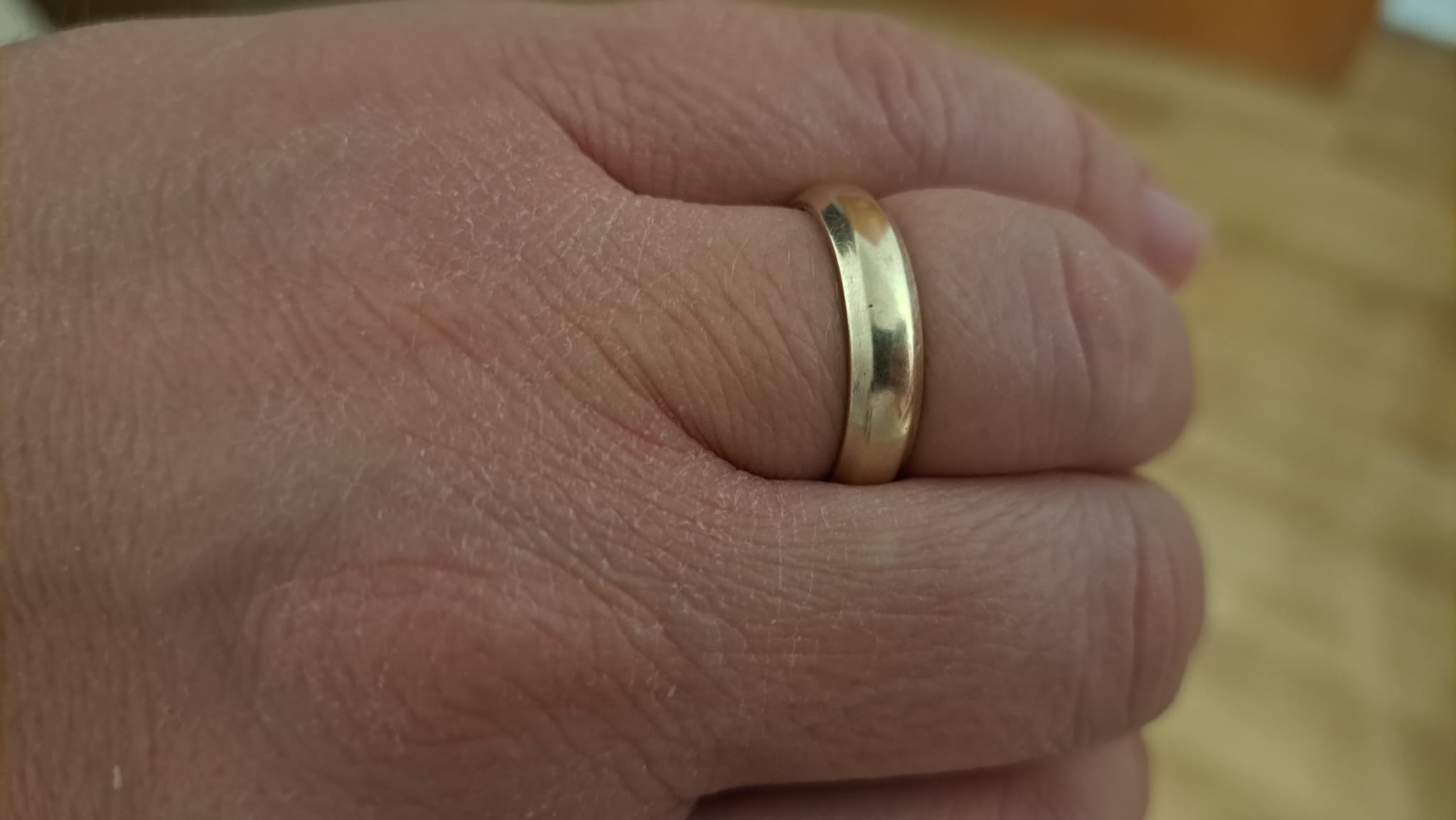 Un botoșănean a ajuns la SPITAL cu degetul inelar umflat, pentru că i s ...